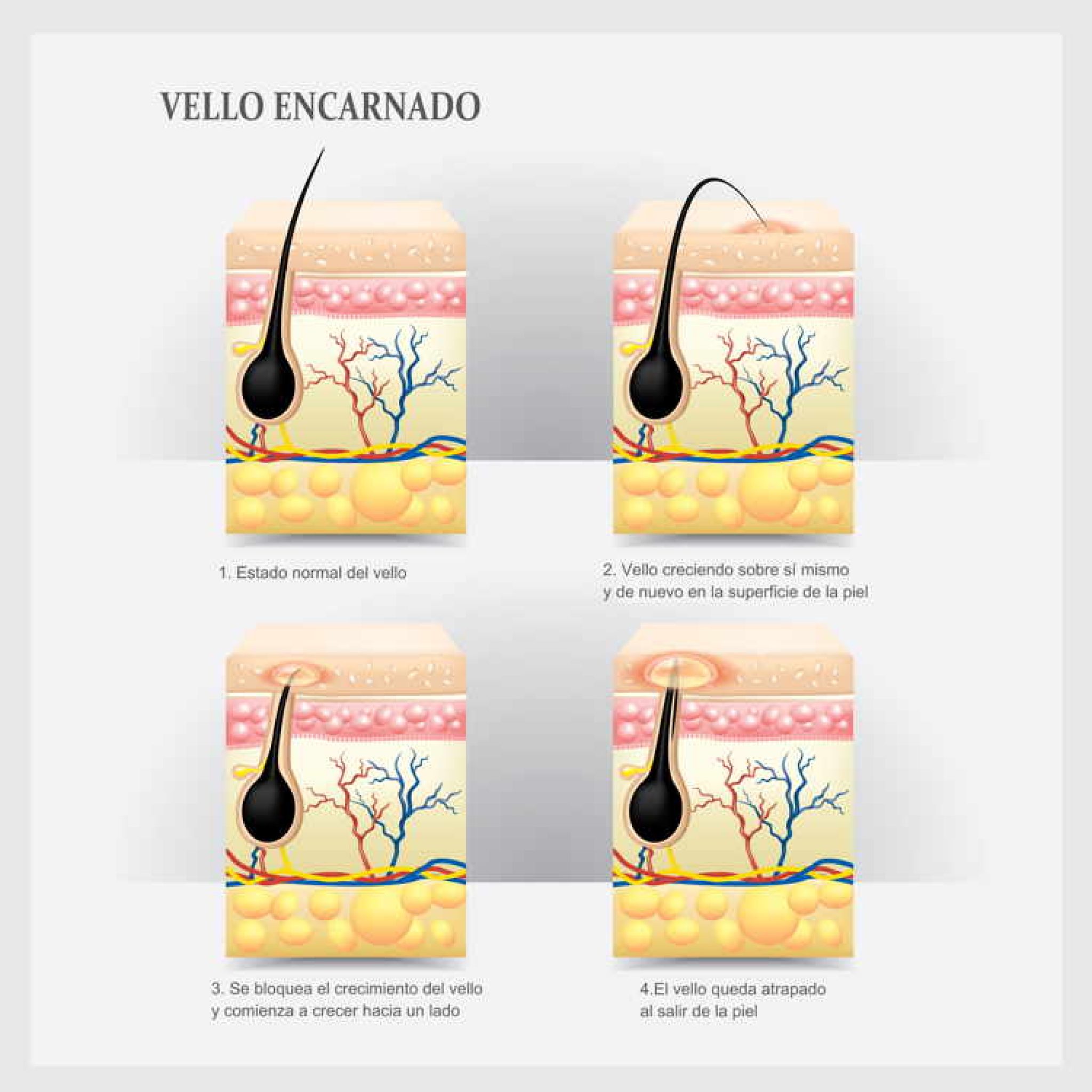 Razones por las que puedes tener 【VELLO FACIAL ENCARNADO】